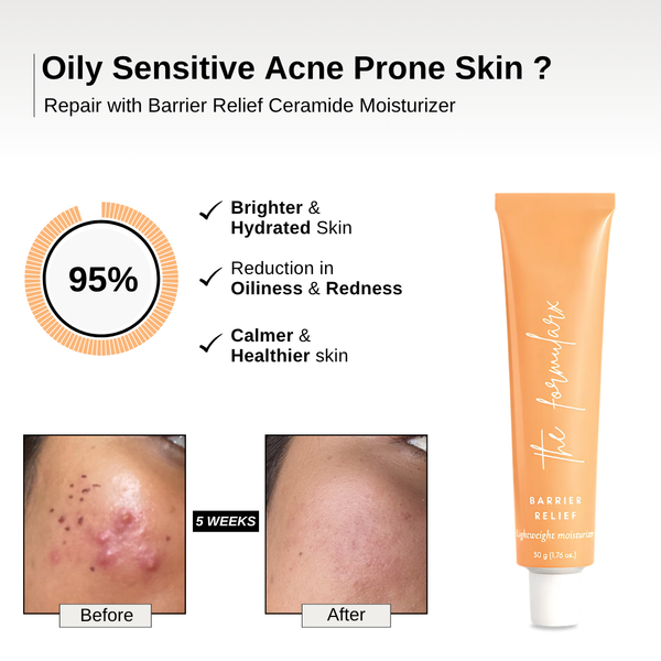 Barrier Relief Lightweight Ceramide Moisturizer - For Oily, Combination ...