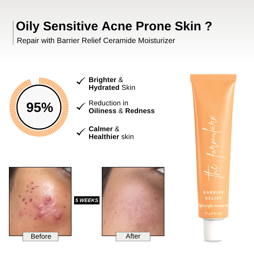 Barrier Relief Lightweight Ceramide Moisturizer - For Oily, Combination ...